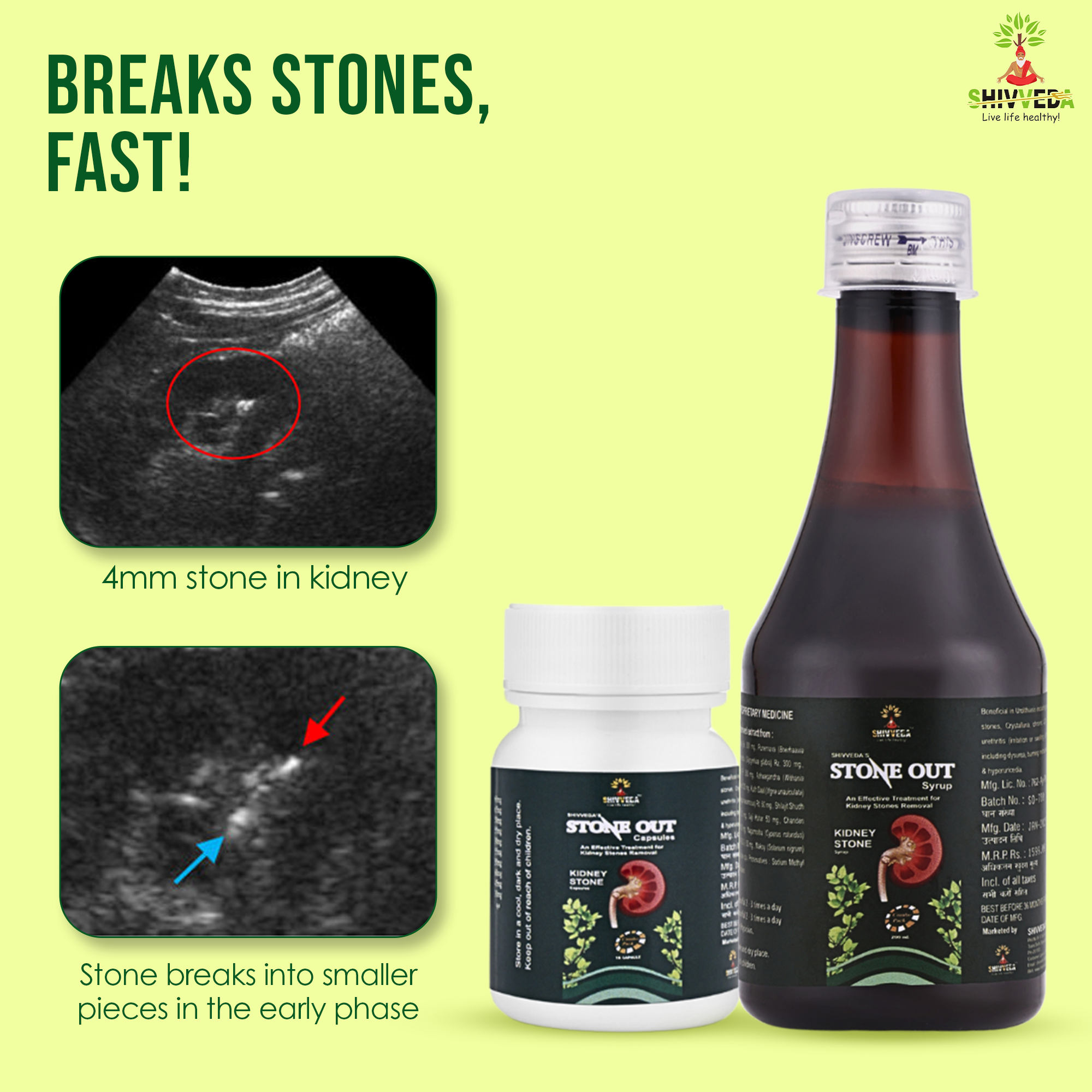 Stone Out Capsules & Syrup for Kidney Stone Support | Herbal Urinary ...
